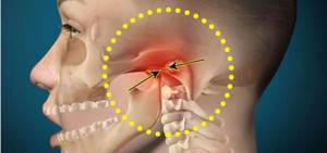 Why the cheekbone and jaw near the ear on the left and right hurt, it ...