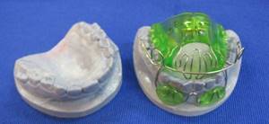 Klamt activator for teeth: a device for correcting bite